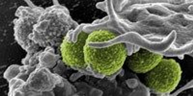 Image of the Day: Hospital Infection | The Scientist
