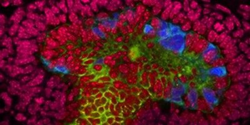 Lab-Grown Kidney Buds | The Scientist