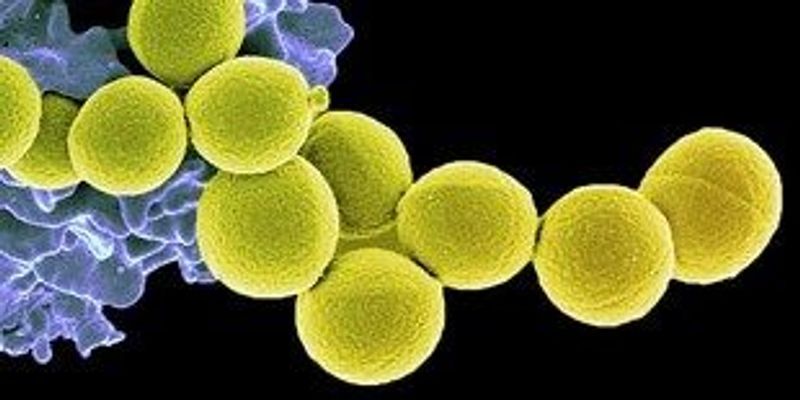 Thwarting Persistence | The Scientist