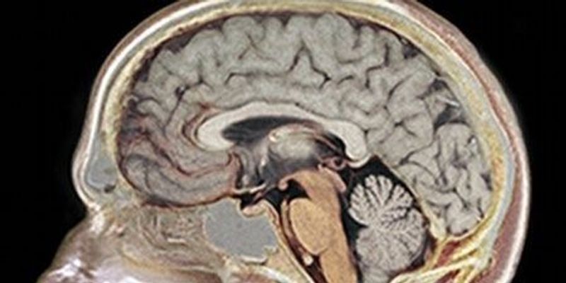 Genetic Diversity in the Brain | The Scientist