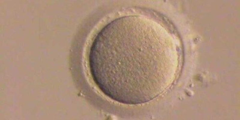 Gravity Determines Cell Size | The Scientist