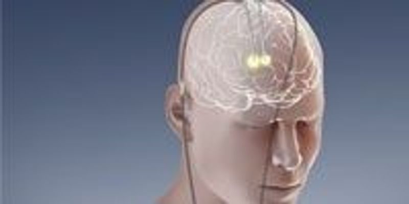 Tuning the Brain | The Scientist