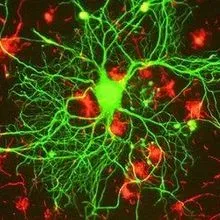 Image of the Day: Neon Neuron | The Scientist
