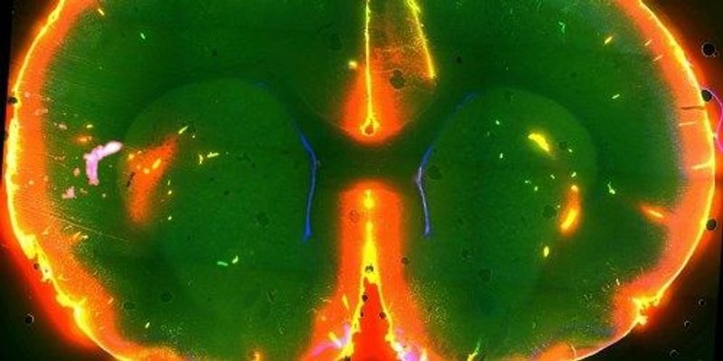 Brain-Washing During Sleep | The Scientist