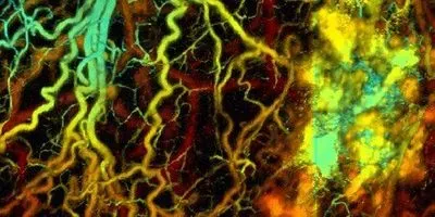 Image of the Day: Colorful Cancer | The Scientist