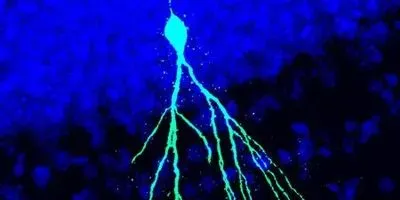 Image of the Day: Newborn Neuron | The Scientist