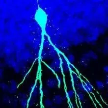 Image of the Day: Newborn Neuron | The Scientist