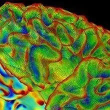 Preliminary BRAIN Plans | The Scientist