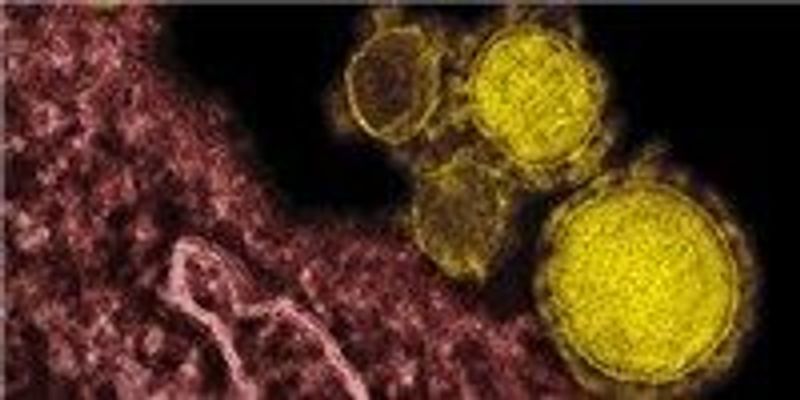The Many Mysteries of MERS | The Scientist