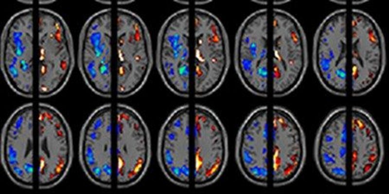 Brain-Based Labels Bunk? | The Scientist