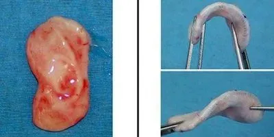 Lab-Grown Ear | The Scientist