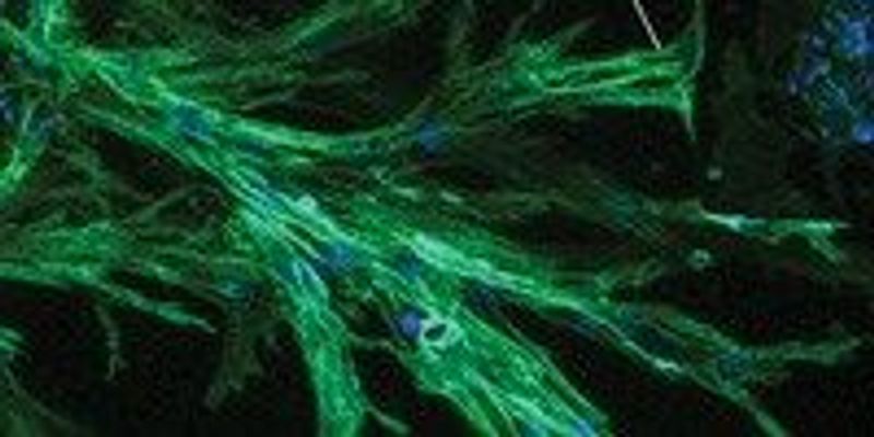 Cellular Pegs-in-Holes | The Scientist