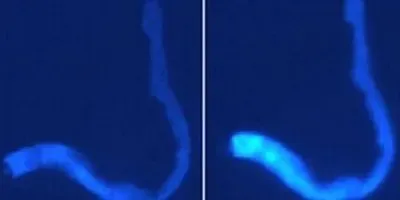 Dying Worms Emit Ethereal Glow | The Scientist