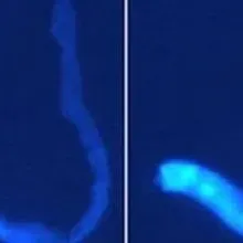 Nematodes | The Scientist