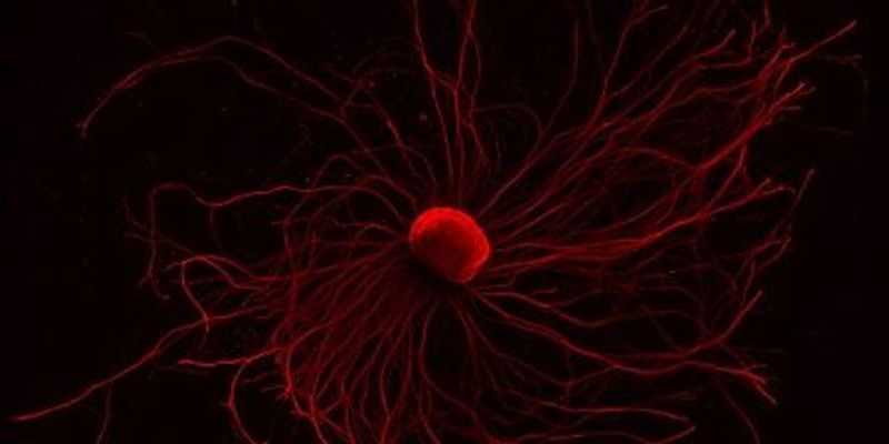 Image of the Day: Growing Retinal Neurons | The Scientist