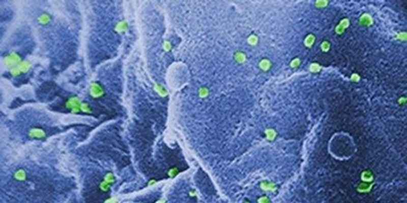 Gut Microbes Exacerbate HIV? | The Scientist