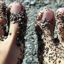 Foot Fungus Revealed | The Scientist