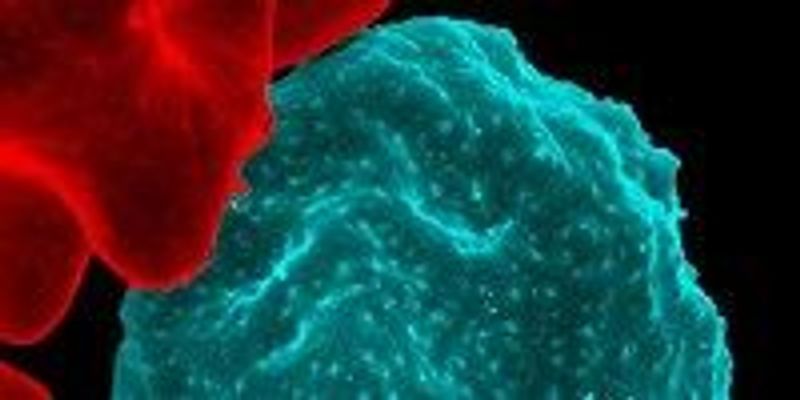 Image of the Day: Lumpy Cell | The Scientist