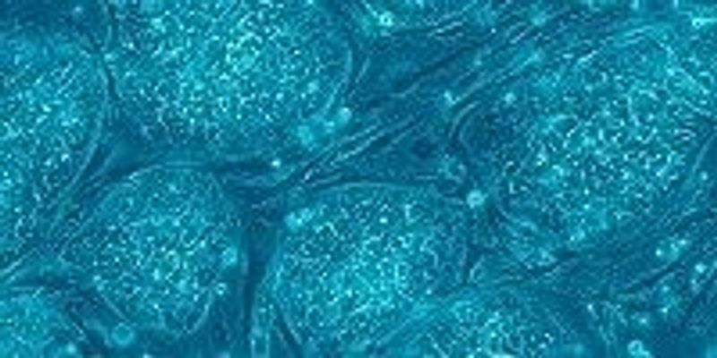 Italy Orders Trials of Unproven Therapy | The Scientist