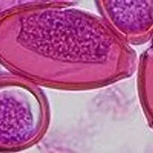 Image of the Day: Parasite Eggs | The Scientist
