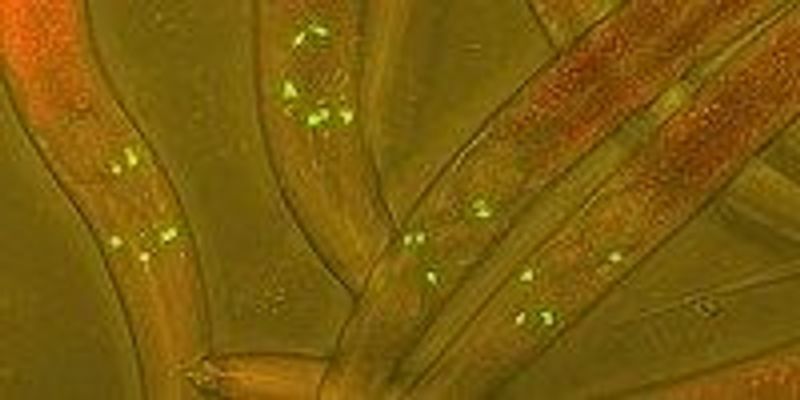 Image of the Day: Fluorescent Neurons | The Scientist