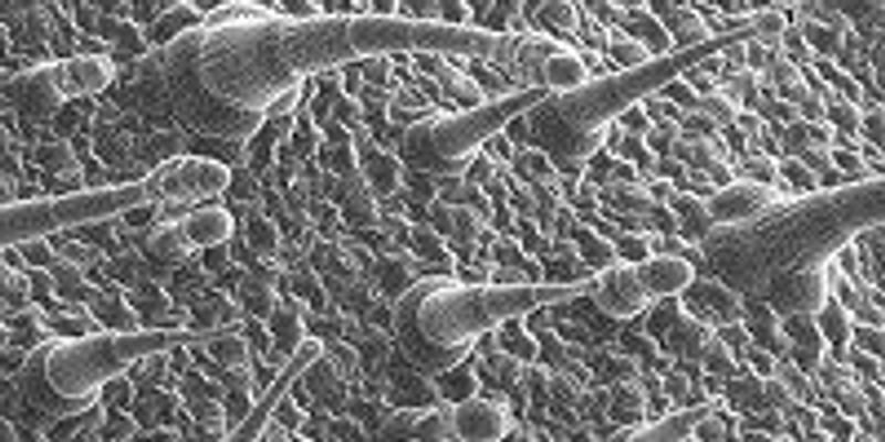 Image of the Day: Spiky Surface | The Scientist