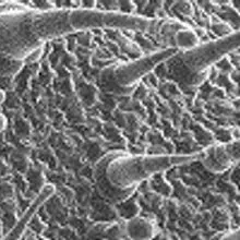 Image of the Day: Spiky Surface | The Scientist