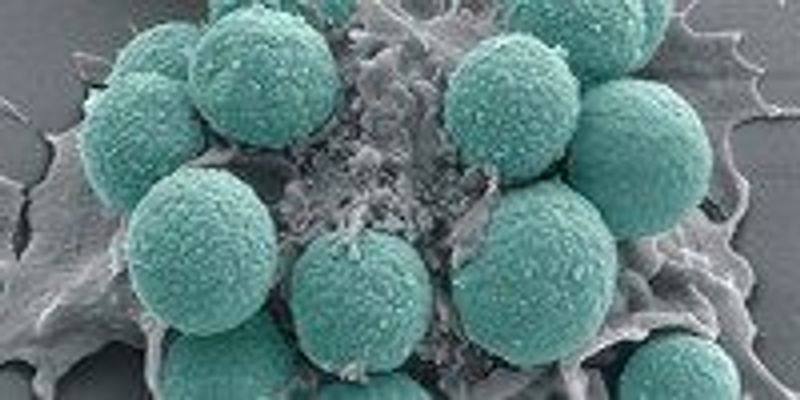 Image of the Day: Immune System at Work | The Scientist Magazine®