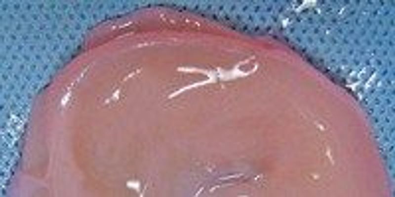 Image of the Day: Artificial Ear | The Scientist Magazine®