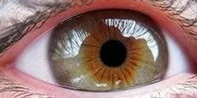 New Approach for Failing Vision | The Scientist