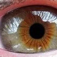 New Approach for Failing Vision | The Scientist