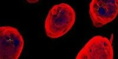 Image of the Day: Intestinal Ingress | The Scientist