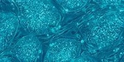 Supreme Court Rejects Stem Cell Case | The Scientist