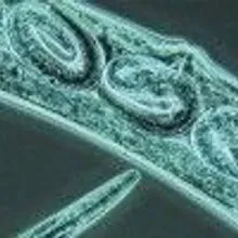 High-content Screening | The Scientist