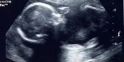 Year of the Fetus | The Scientist