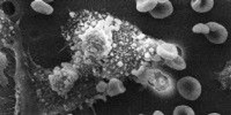Texas Cancer Institute in Hot Water, Again | The Scientist