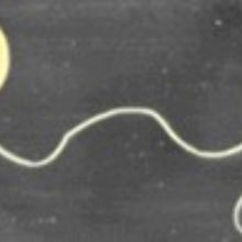 Helminths News, Articles | The Scientist Magazine®