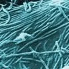 Ebola from Pigs to Monkeys | The Scientist