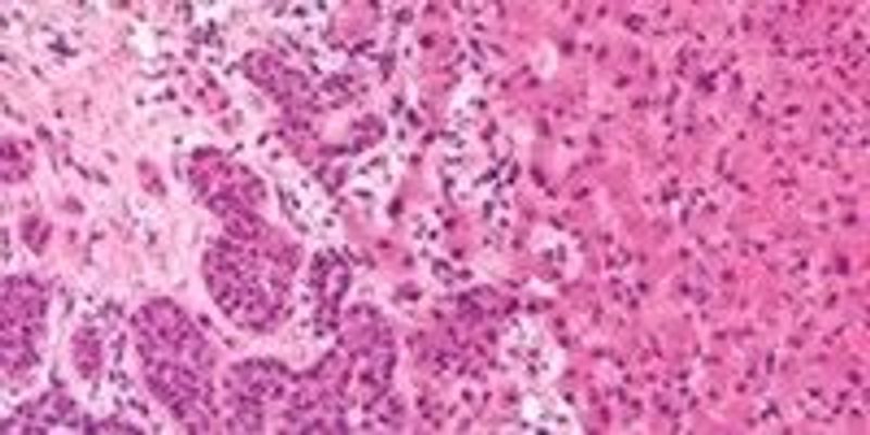 A Window into Cancer | The Scientist