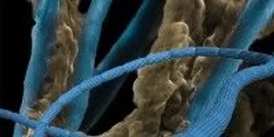 Electrical Bacteria | The Scientist