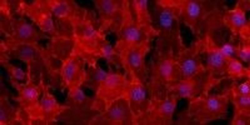 Growing New Neurons | The Scientist