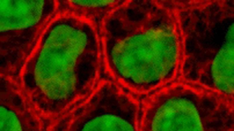 Cancer’s First Step | The Scientist