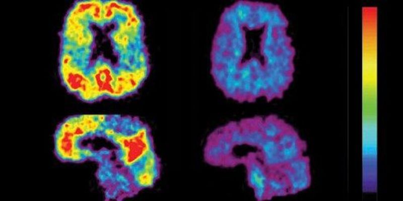 Ready for Prime Time | The Scientist