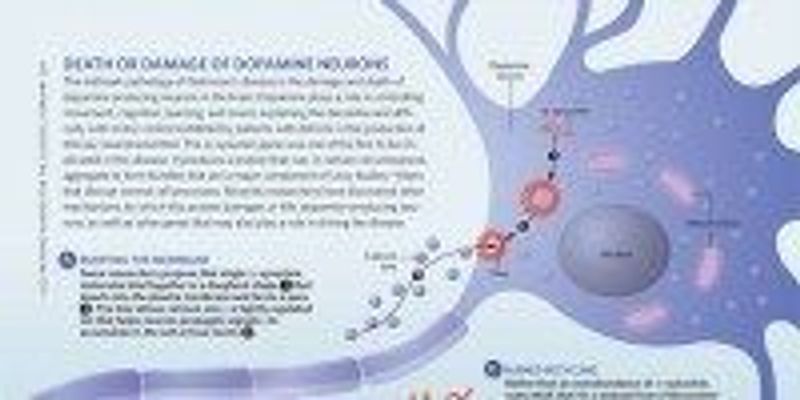 Death or Damage of Dopamine Neurons | The Scientist