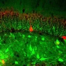 Image of the Day: Memory Jogger | The Scientist