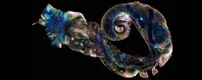 Image of the Day: Uncovered | The Scientist