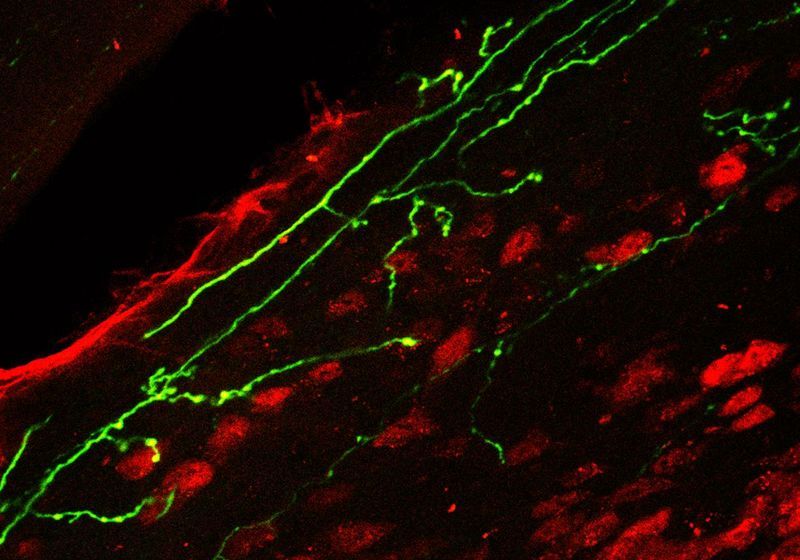 Synthetic Botox Treats Chronic Pain in Mice | The Scientist