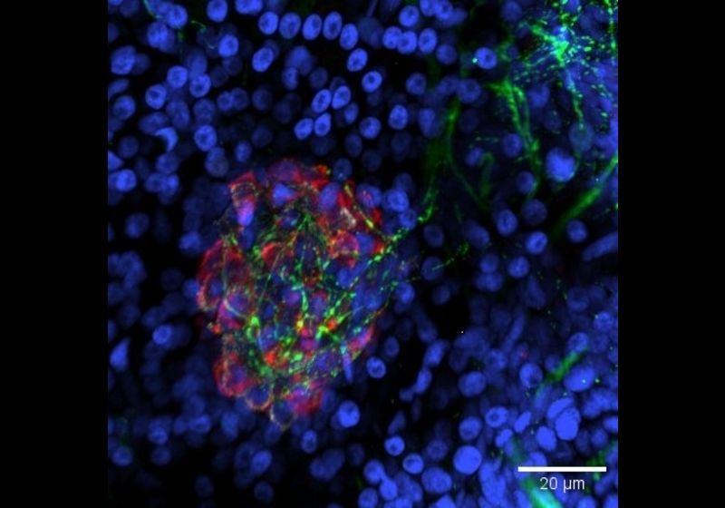 Image of the Day: Bundle of Nerves | The Scientist