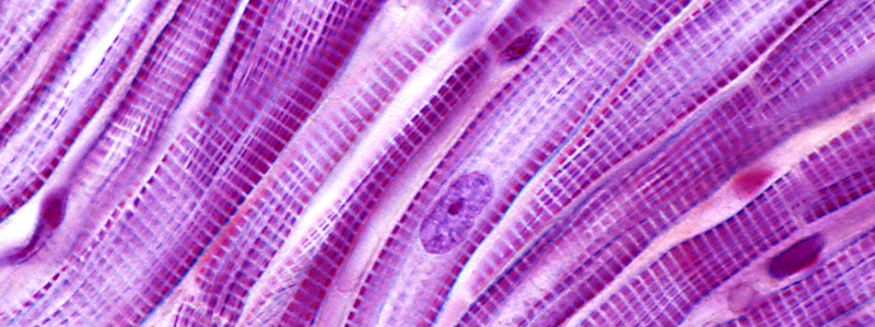 Opinion: Stop Ignoring This Filament Crucial to Muscle Function | The ...