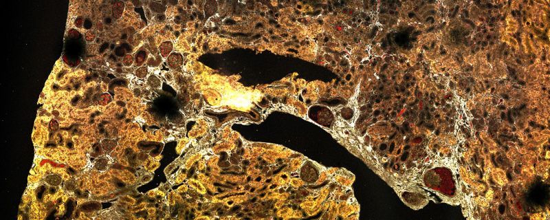 Cause of Mystery Mouse Disease Discovered | The Scientist